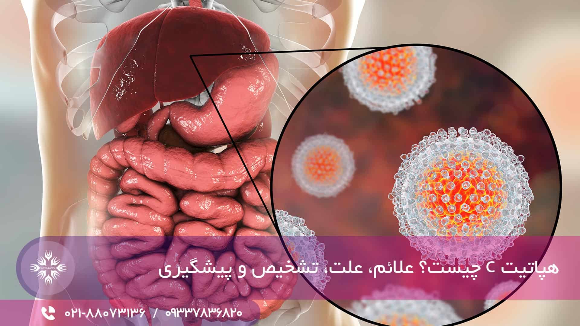 هپاتیت سی C چیست؟ علائم، علت، تشخیص و پیشگیری دکتر فرشاد خسروی