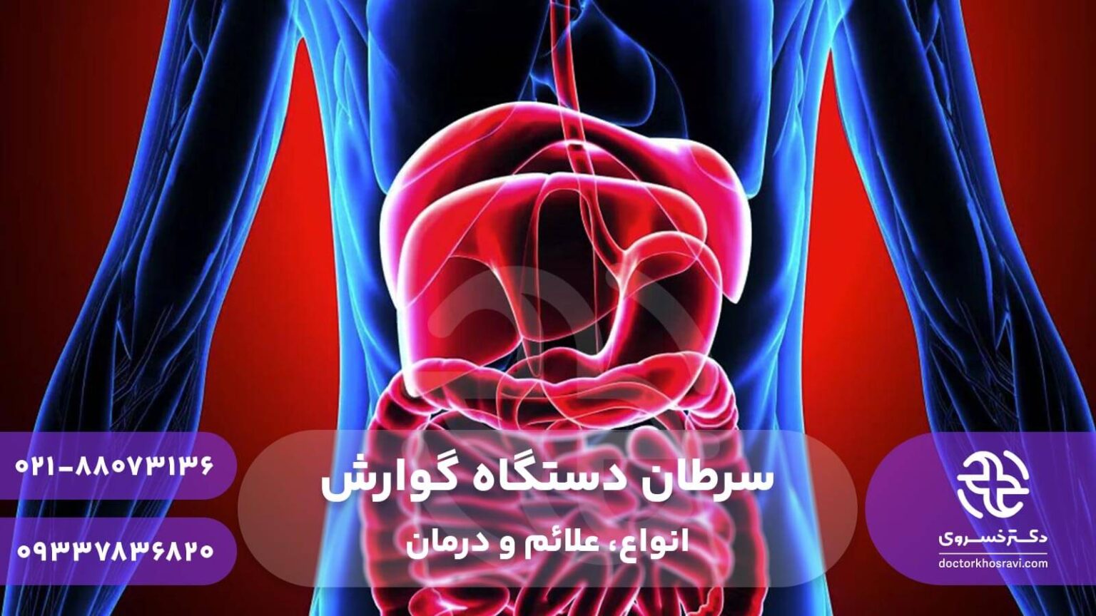 سرطان دستگاه گوارش انواع، علائم و درمان دکتر فرشاد خسروی